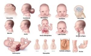 10 formas sencillas de prevenir defectos de nacimiento en su bebé ...